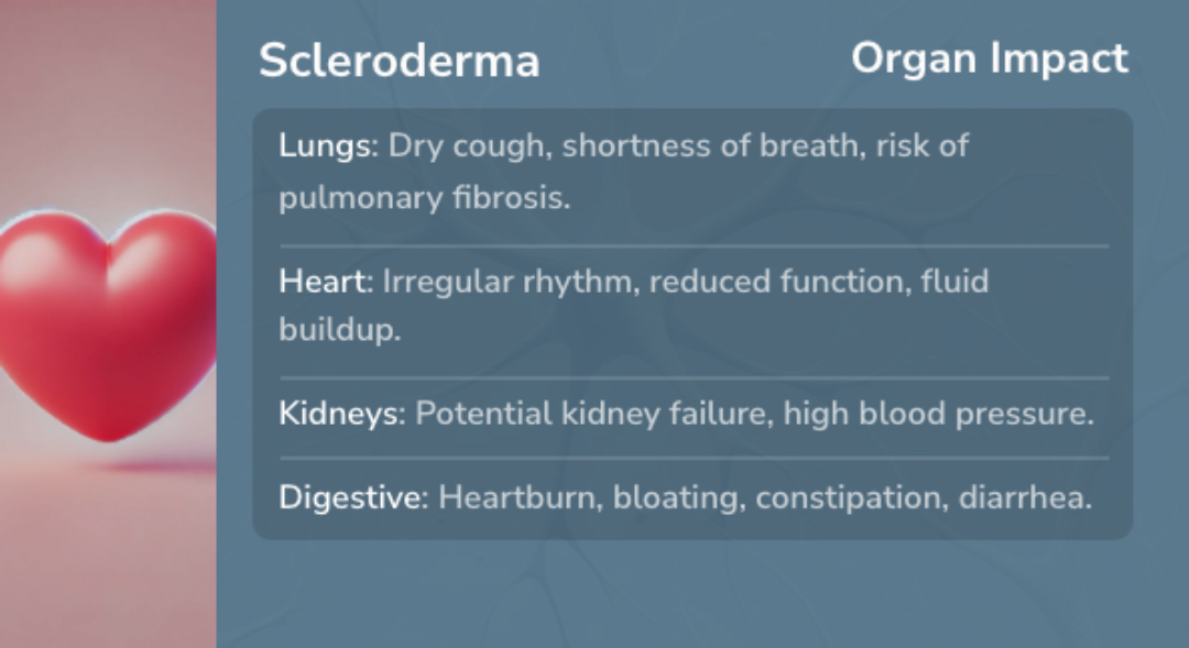 Systemic Sclerosis Organ Complications | Evidence Summary